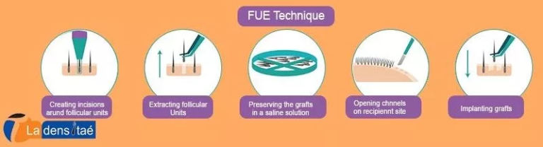 #1 Hair Transplant Clinic In Lucknow | Hair transplant doctor In ...